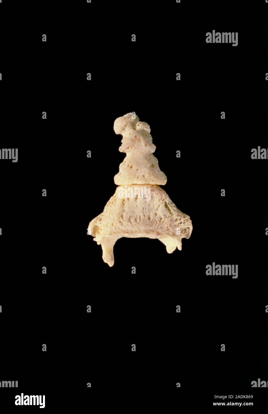 Photograph of the human coccyx, a small triangular bone consisting of ...