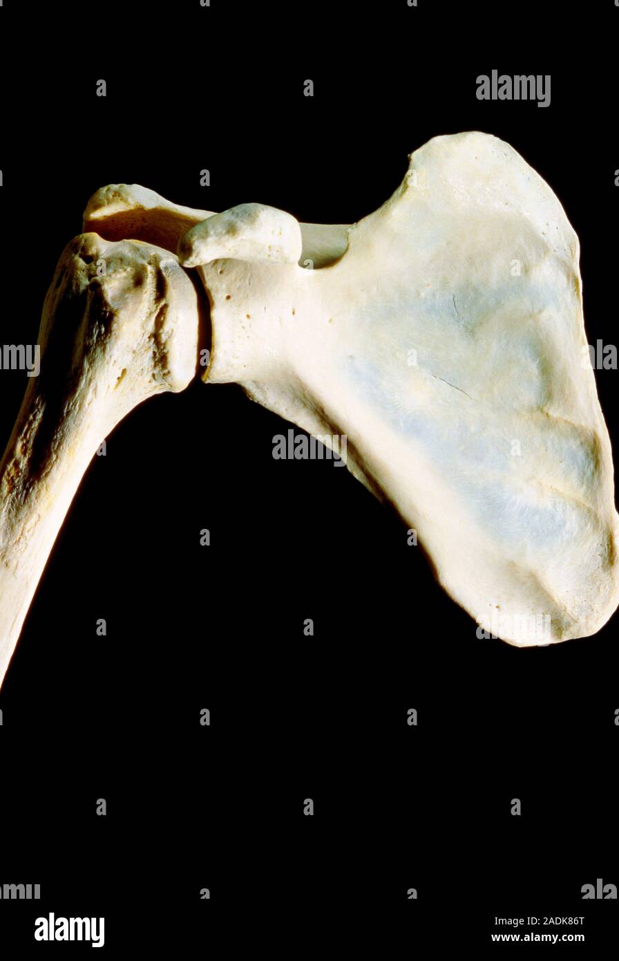 Photograph of the skeleton of the right human shoulder joint, viewed ...
