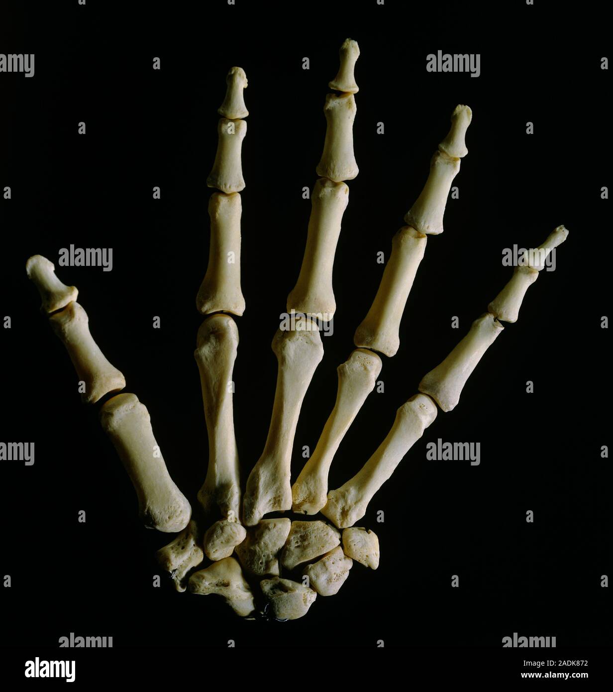 Photograph of the skeleton of an adult human right wrist and hand, seen ...