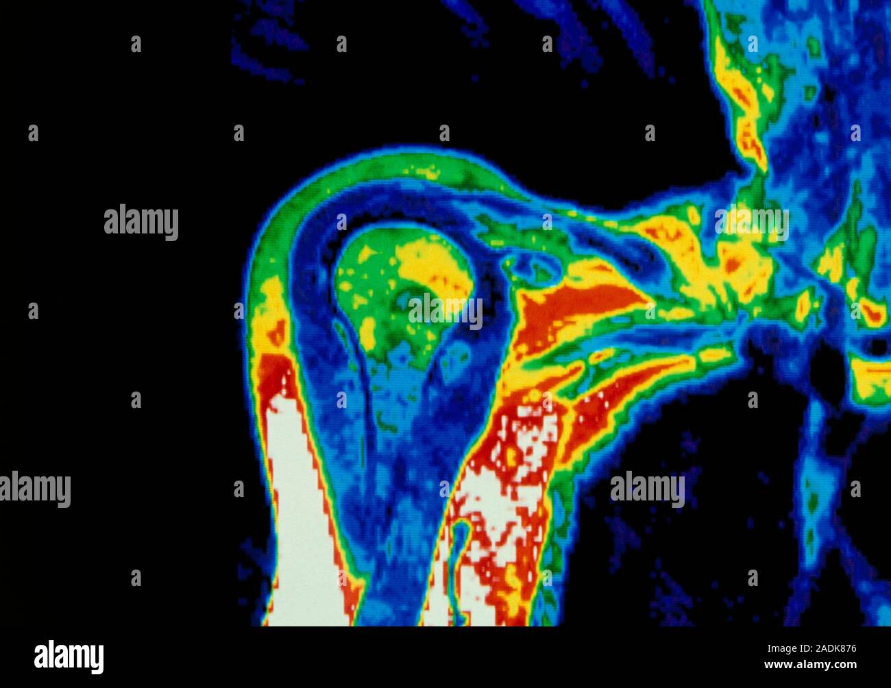 False-colour magnetic resonance image (MRI) of a frontal section ...