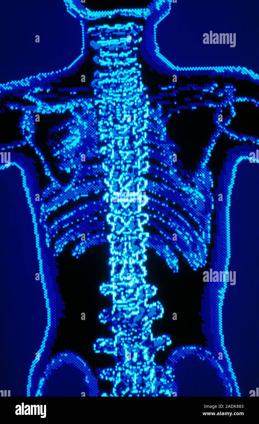 Computer graphic representation of the upper part of the human body ...