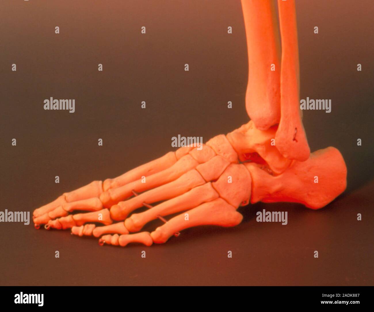 Foot bones. Side view of the bones in a normal human foot. The tibia ...