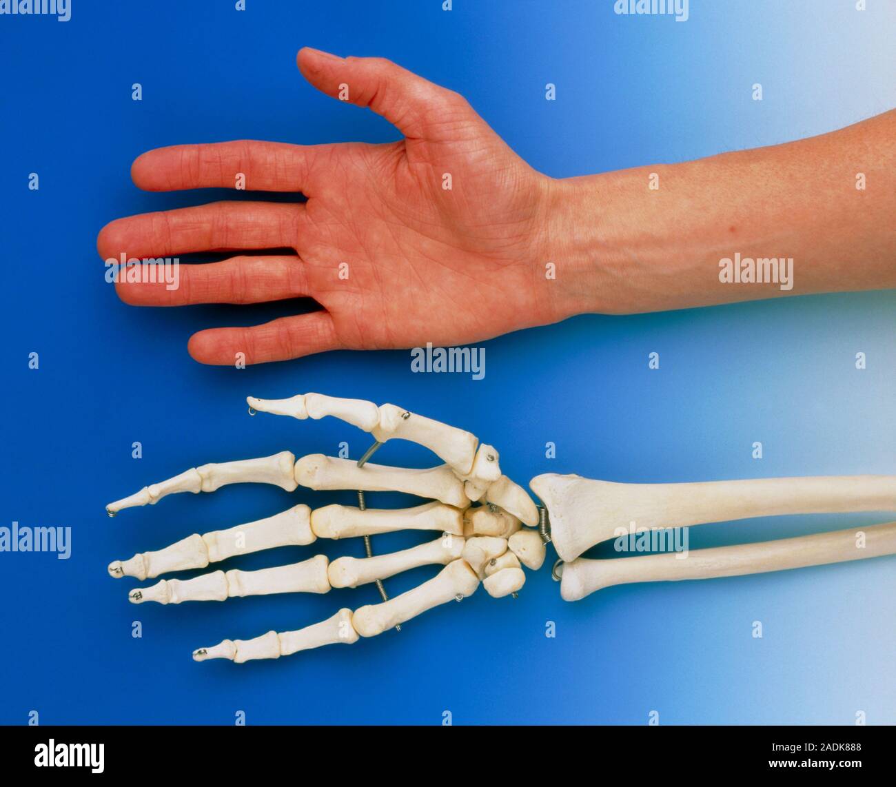 Human arm beside its skelton for comparison. There are 29 bones in the ...