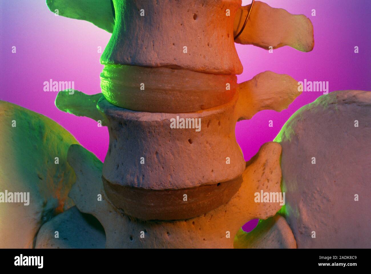 Lower back bones. Close-up of the bones of the lower back from a female ...