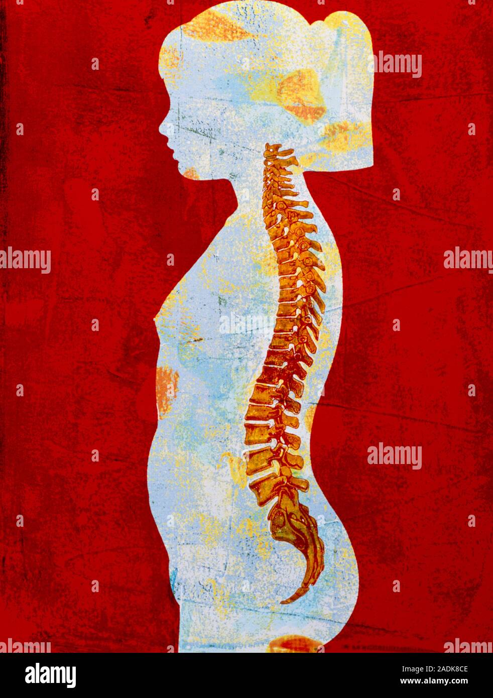Spine. Artwork of the human spine superimposed on the profile of a ...