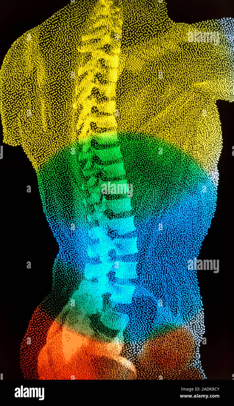 Spine. Coloured three-dimensional computed tomography (CT) scan of a ...