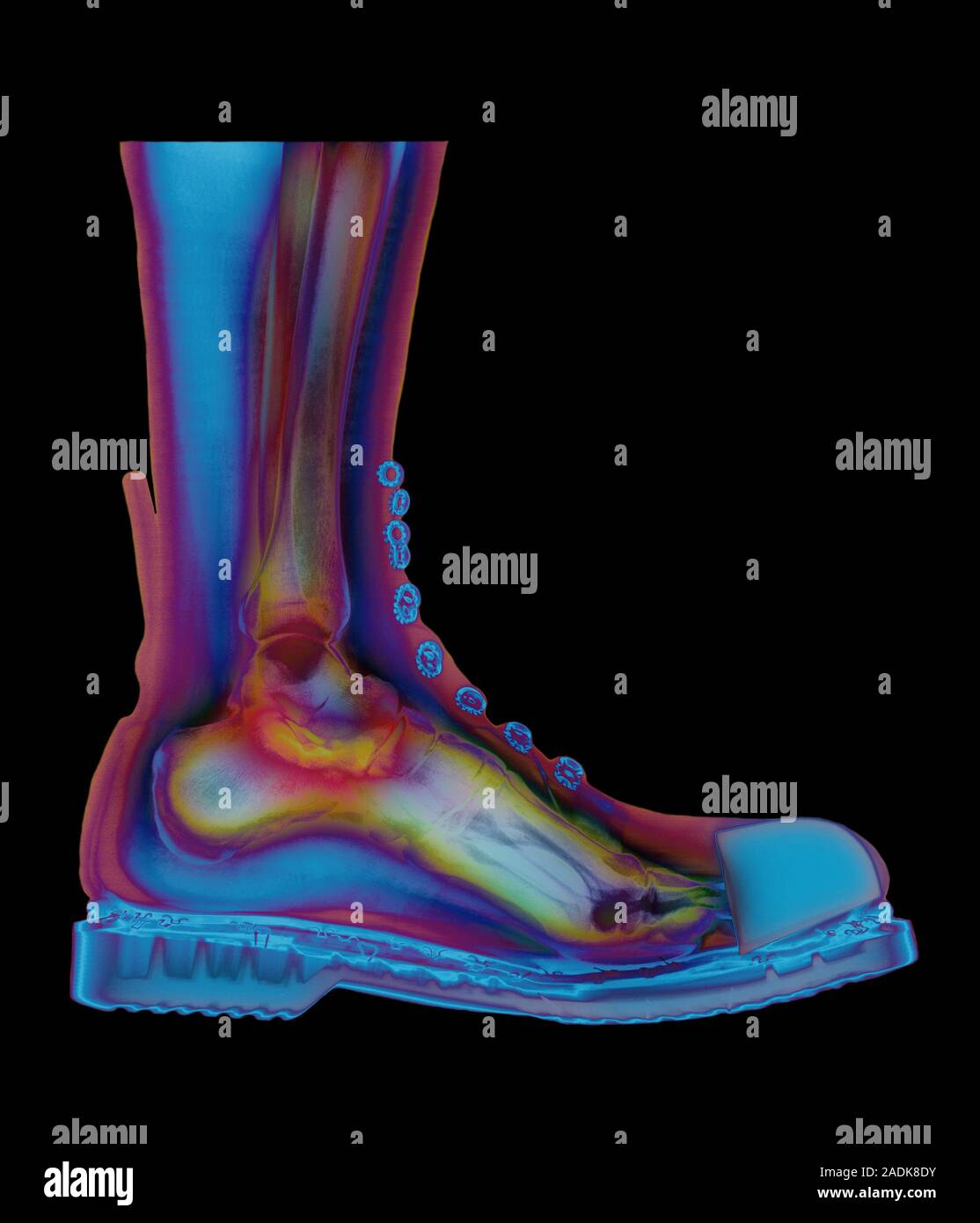 Foot in boot. Coloured X-ray of a man's foot seen in side view, wearing ...