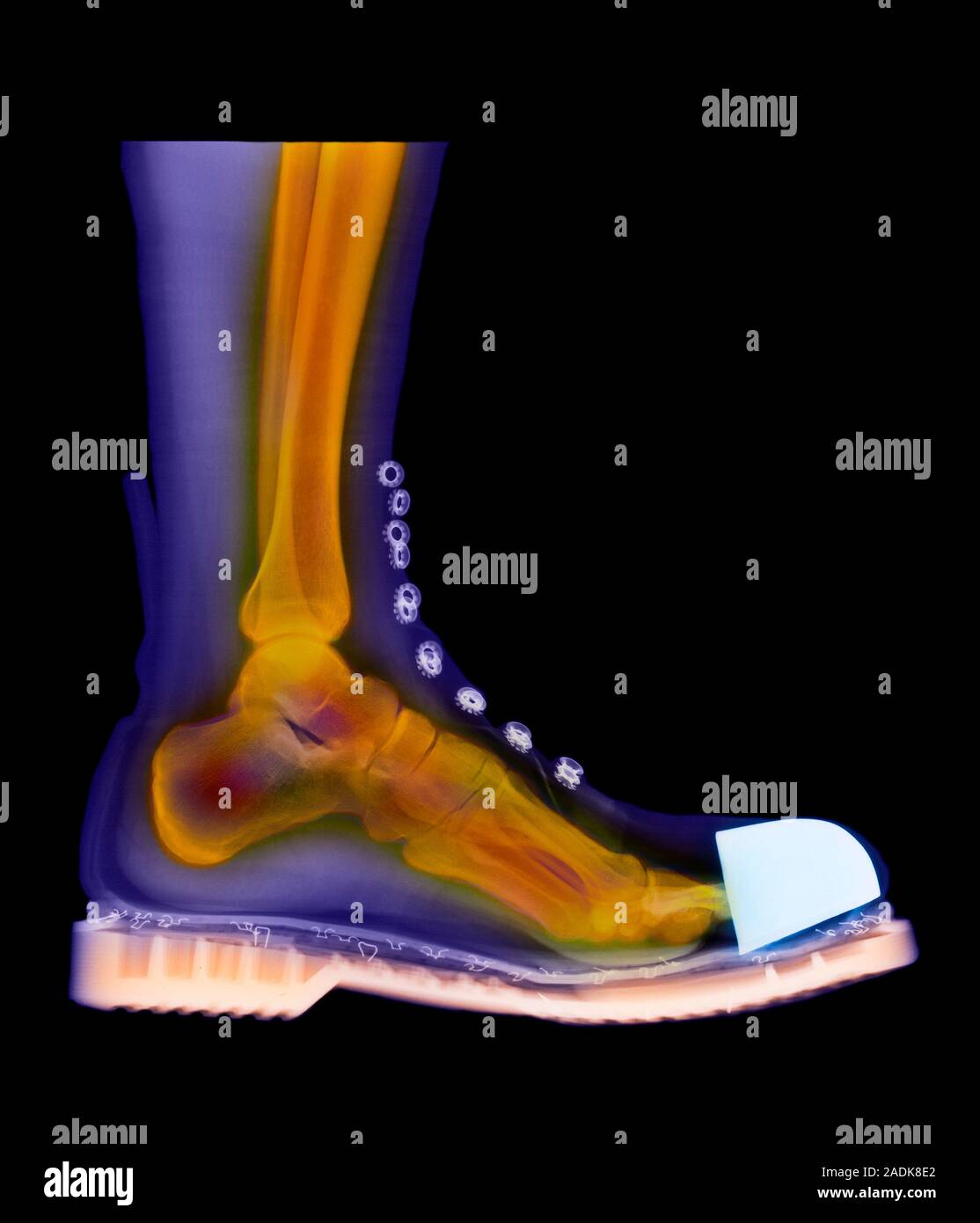Foot in boot. Coloured X-ray of a man's foot seen in side view, wearing ...