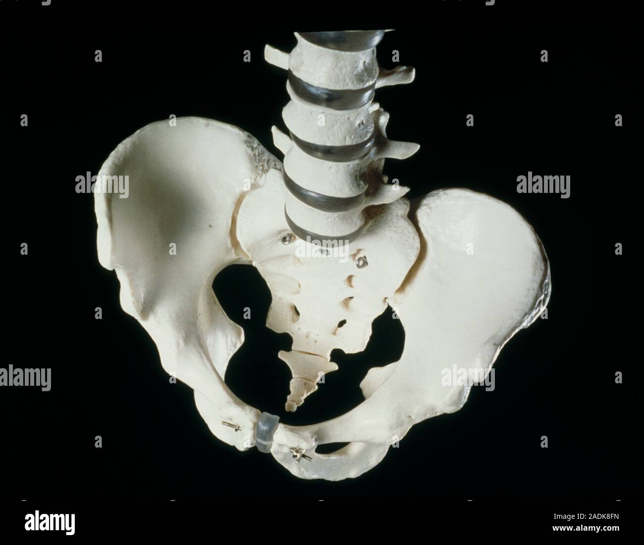 Pelvis. Model of a normal human pelvis and lower back vertebrae. The ...