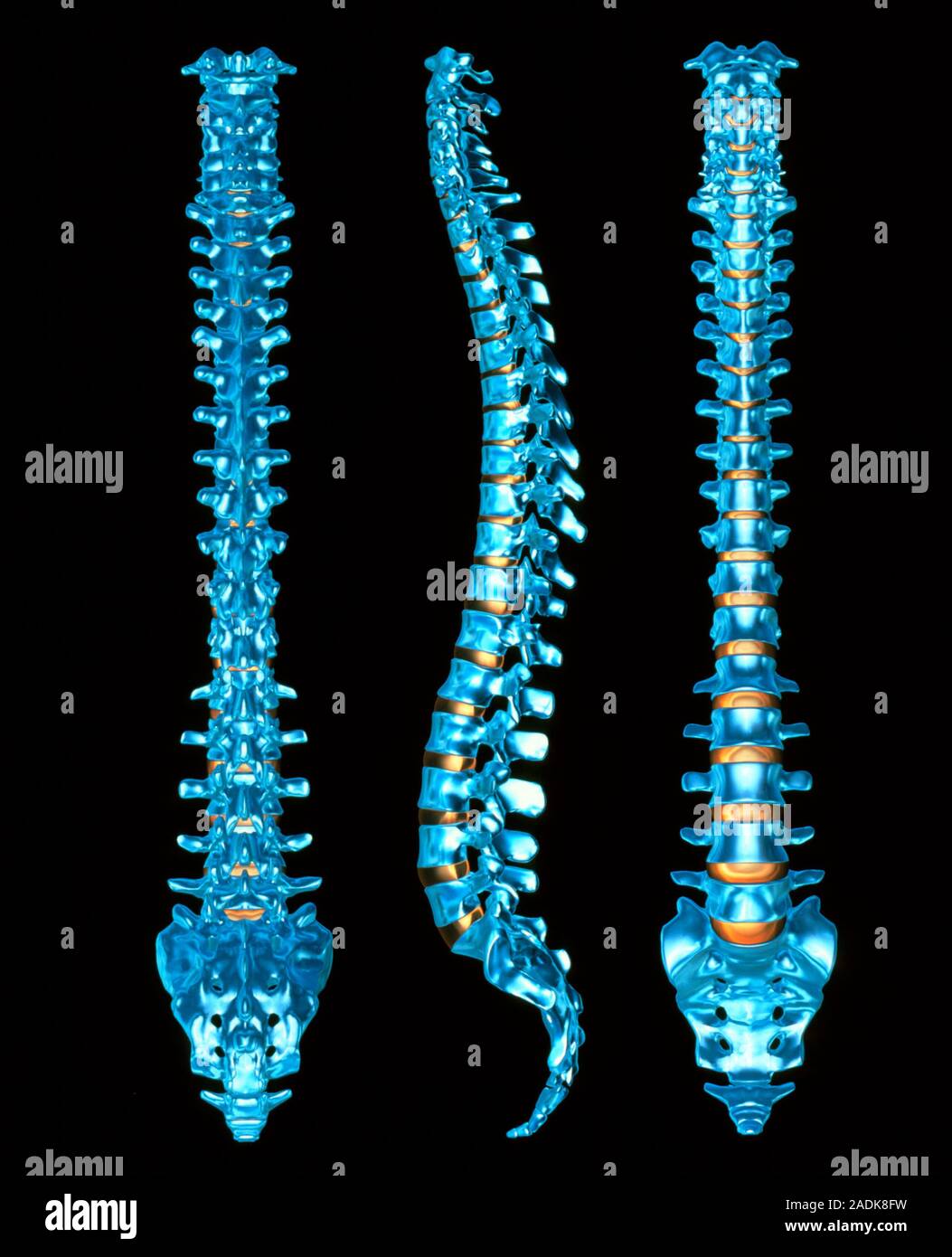 Spine. Computer illustration of three views of a healthy human spine ...