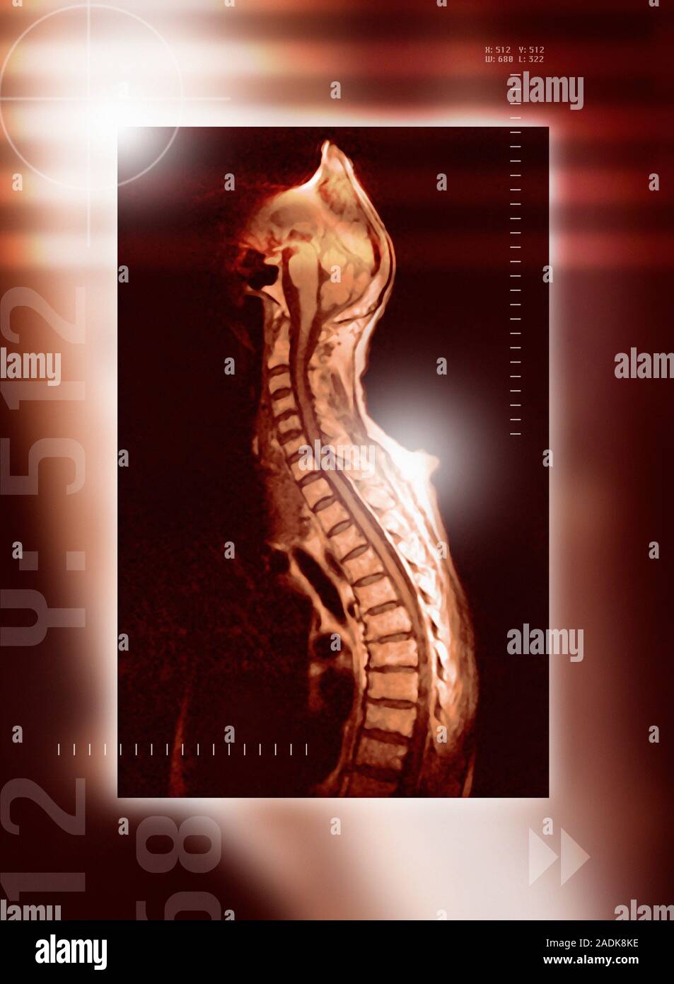 Healthy spine, side view, coloured magnetic resonance imaging (MRI ...