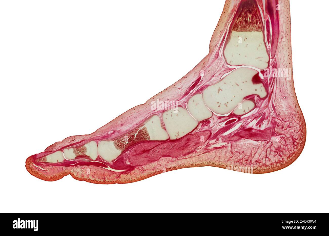 Foetal foot. Macro photograph of a sagittal section through the foot of ...
