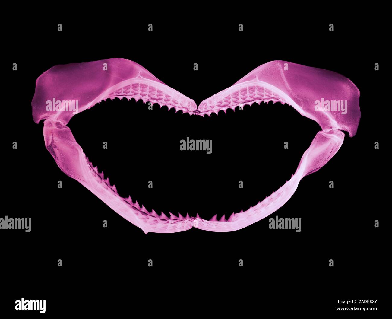 Jaws of a shark, coloured X-ray Stock Photo - Alamy
