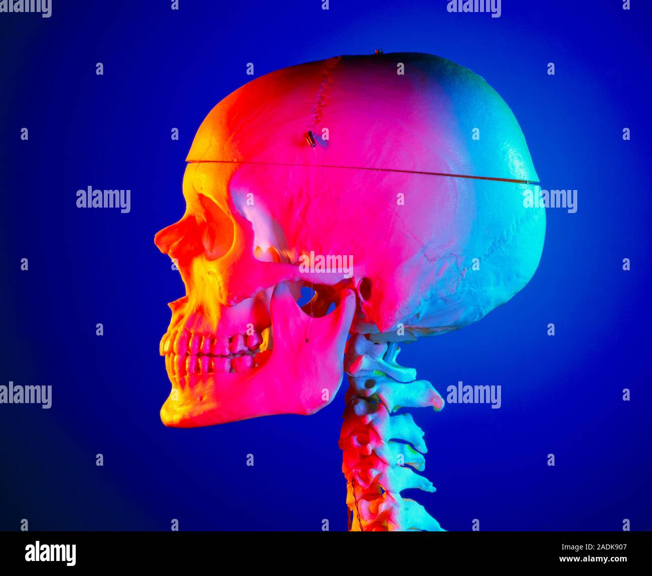 Human skull. Profile of the skull from a female skeleton. At top is the ...