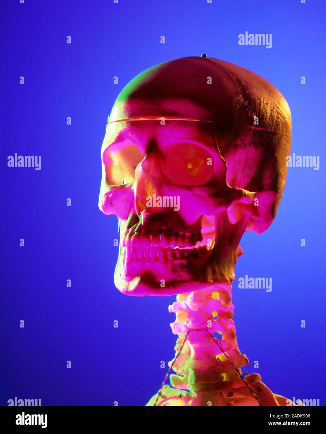 Human skull. The skull from a female skeleton. At top is the rounded ...