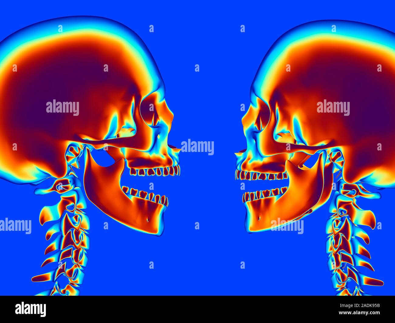 Human skulls. Computer artwork of the heads of two human skeletons ...