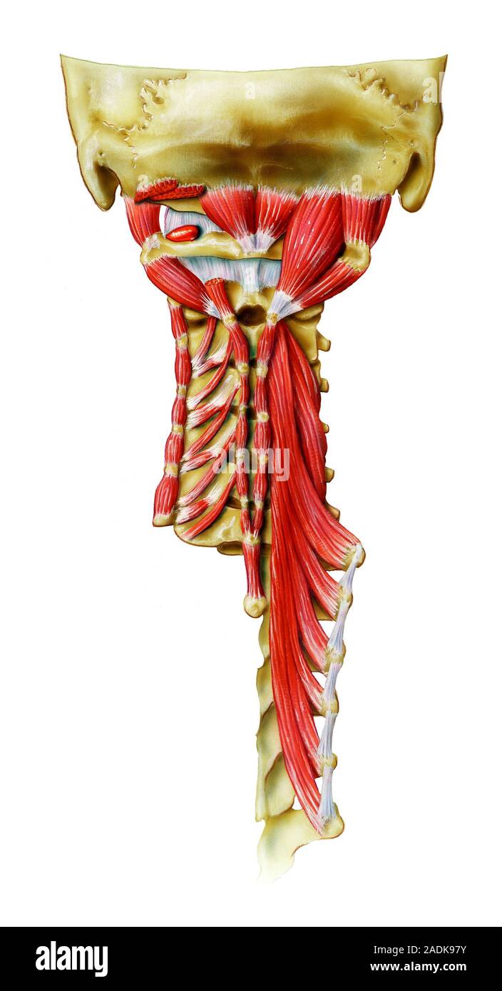 Neck muscles. Artwork showing the anatomy of the posterior neck muscles ...