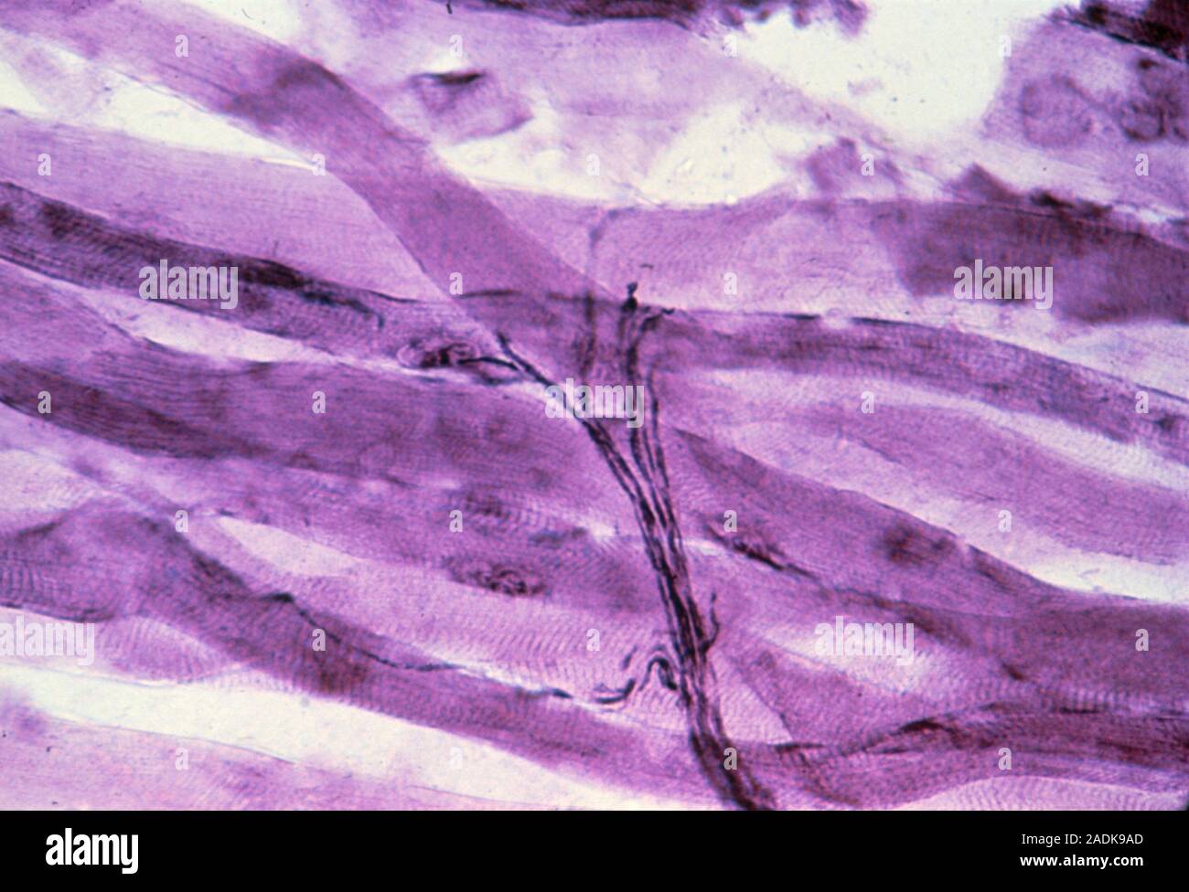 Light micrograph of human striated muscle fibres, showing attachment of ...