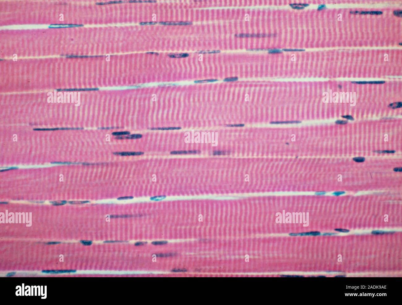 Light micrograph (longitudinal section) of human skeletal muscle ...