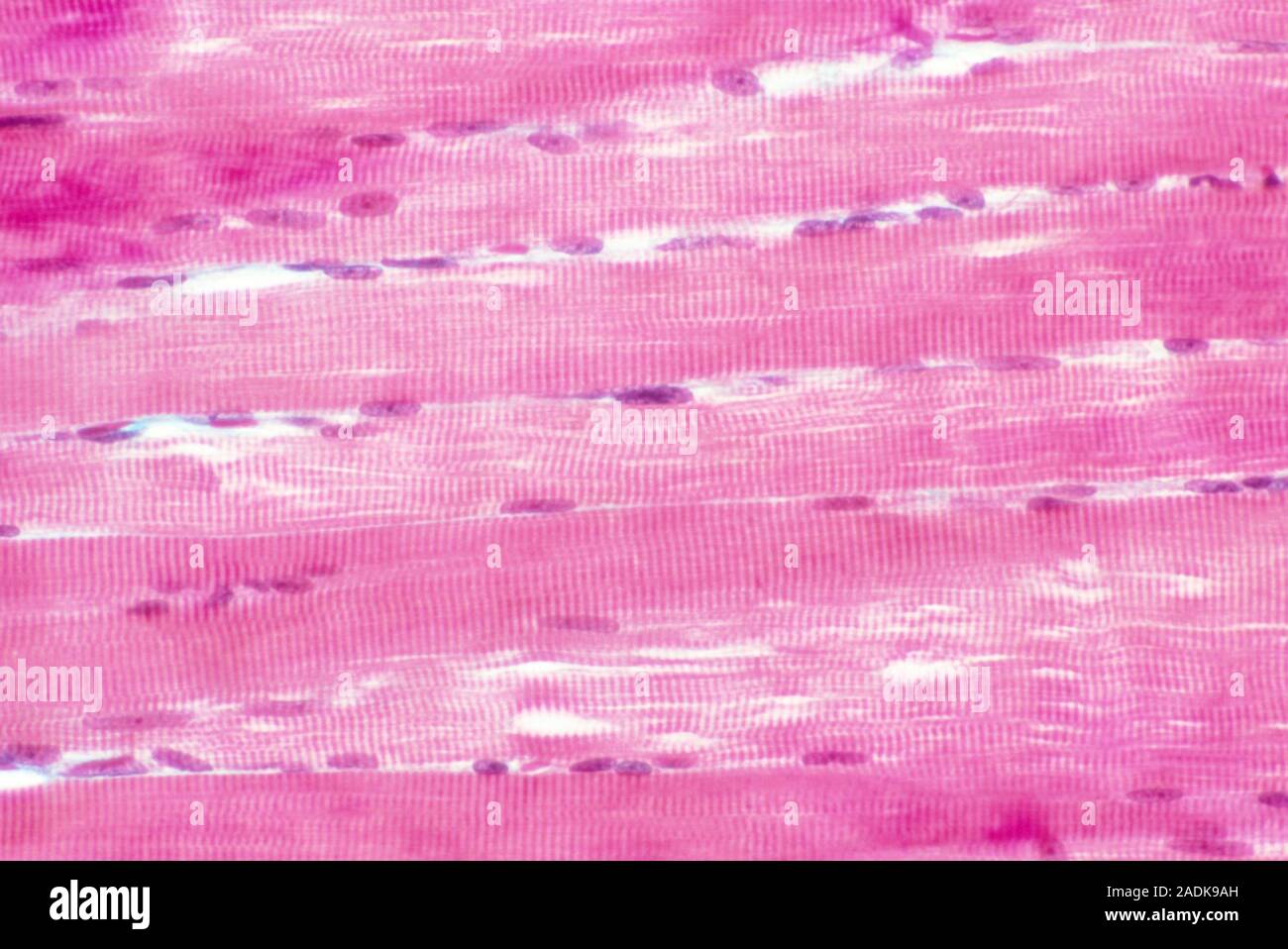 Light micrograph of normal human muscle cells from the neck. Skeletal ...