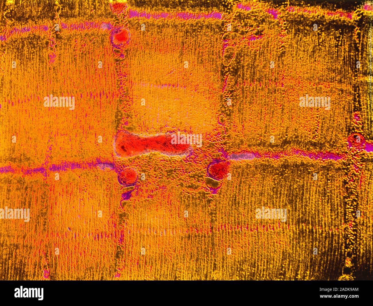 False colour transmission electron micrograph (TEM) showing the organization and banding pattern ...
