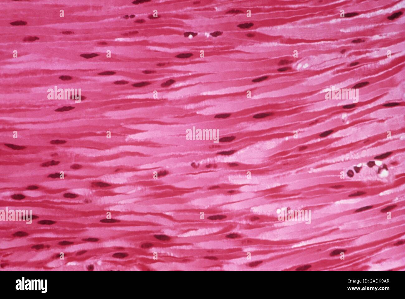 Light micrograph of a section of human smooth muscle. It is composed of ...
