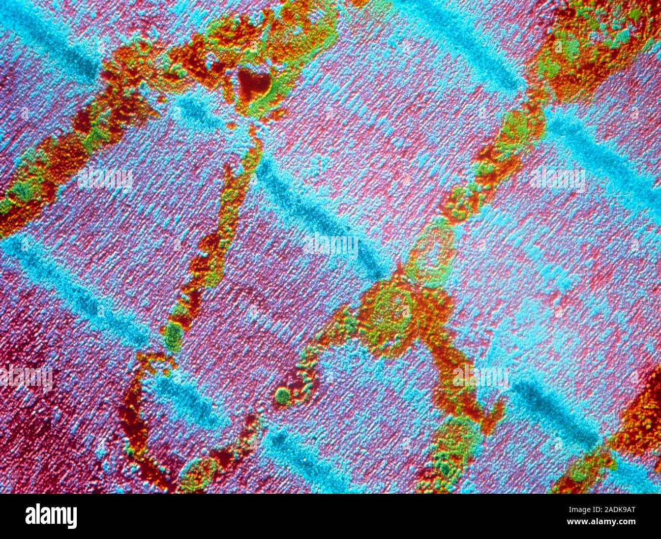 False-colour transmission electron micrograph of a longitudinal section through striated ...