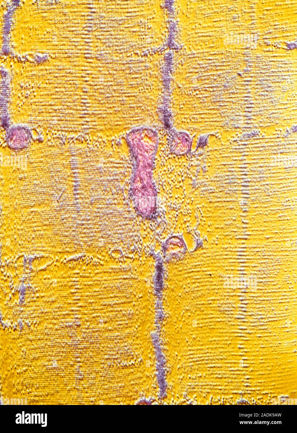 False-colour transmission electron micrograph (TEM) of human striated muscle. Striated muscle ...