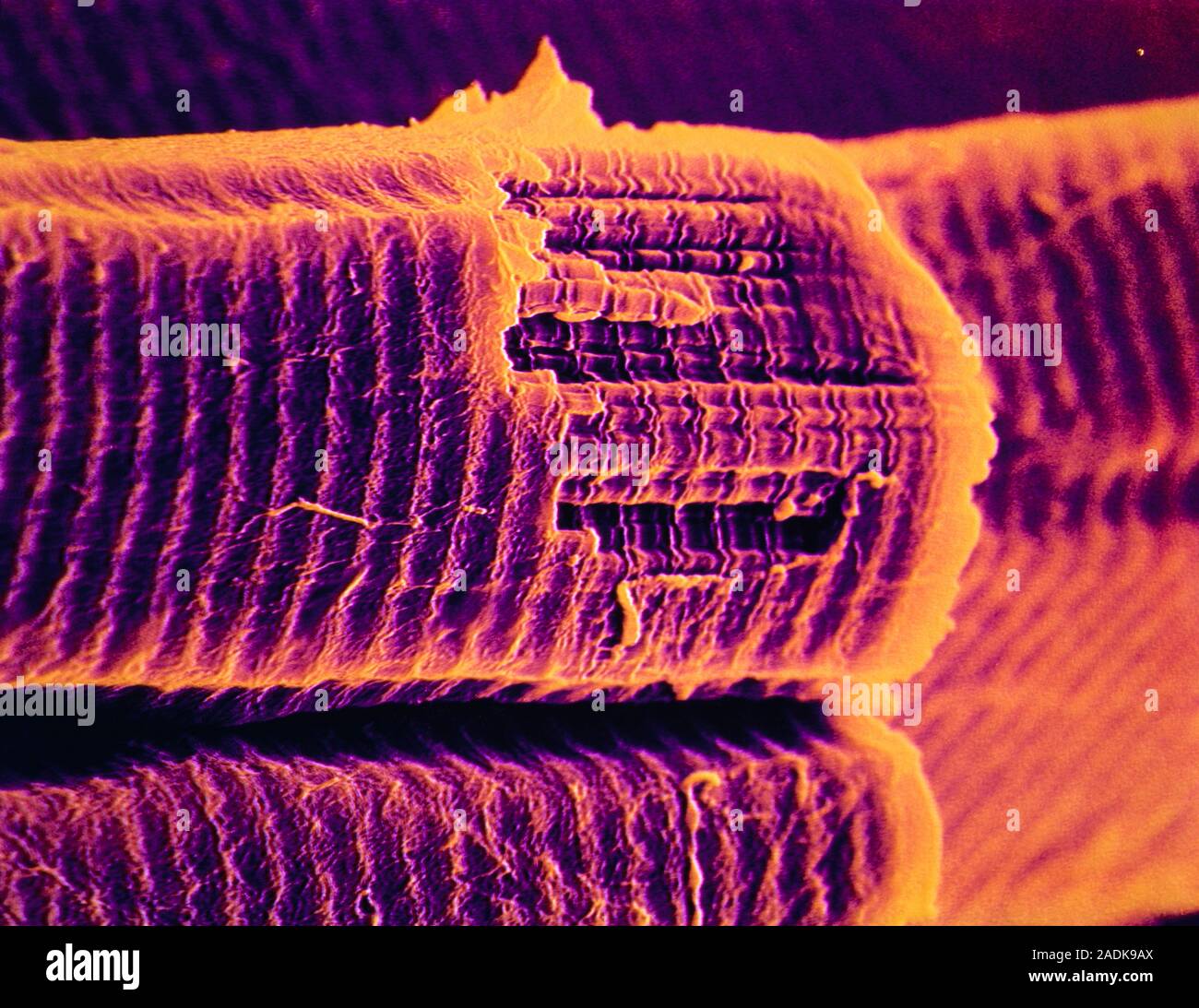 False-colour scanning electron micrograph (SEM) of normal human striated muscle fibres. Striated ...