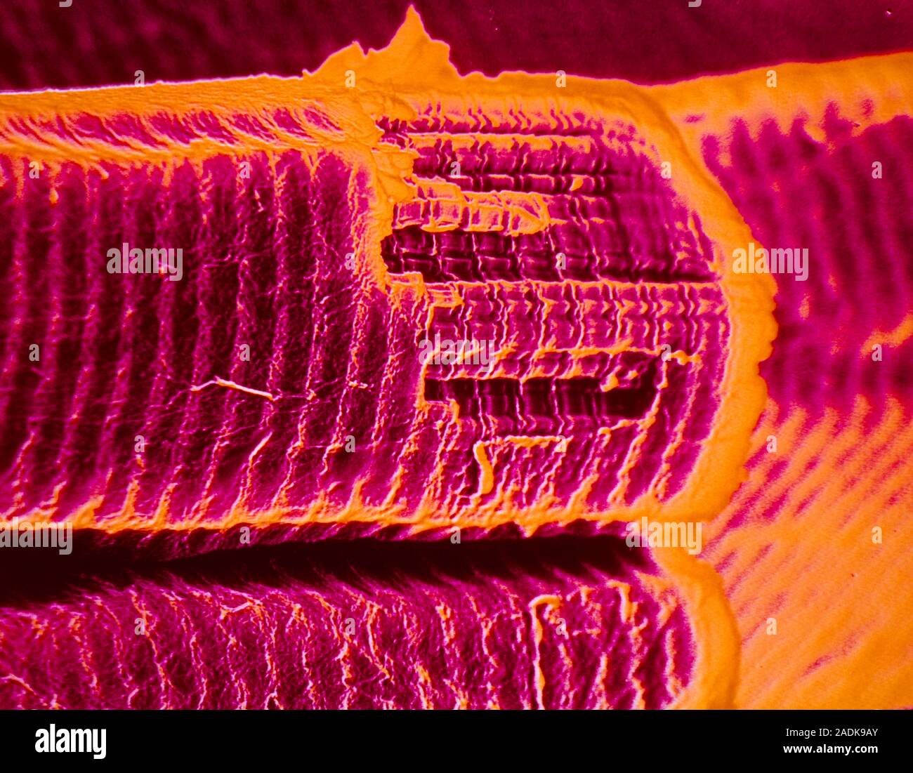 False-colour scanning electron micrograph (SEM) of normal human striated muscle fibres. Striated ...