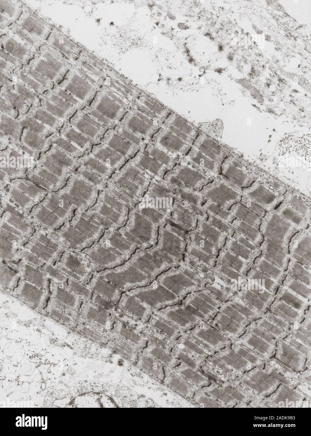 Transmission electron micrograph of part of a striated muscle fibre ...