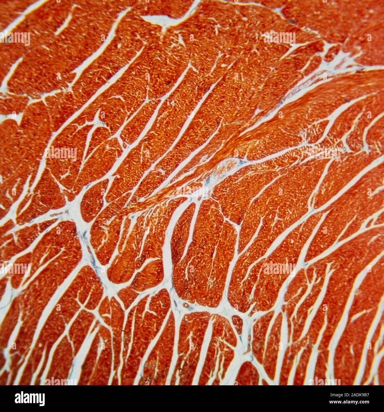 Light micrograph of a cross section through human heart muscle ...