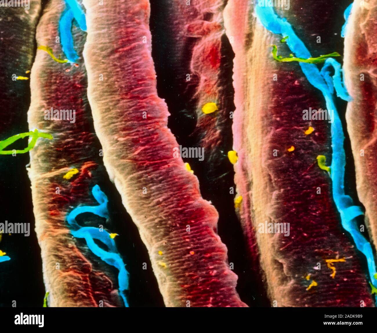 Muscle. False-colour scanning electron micrograph of a bundle of ...
