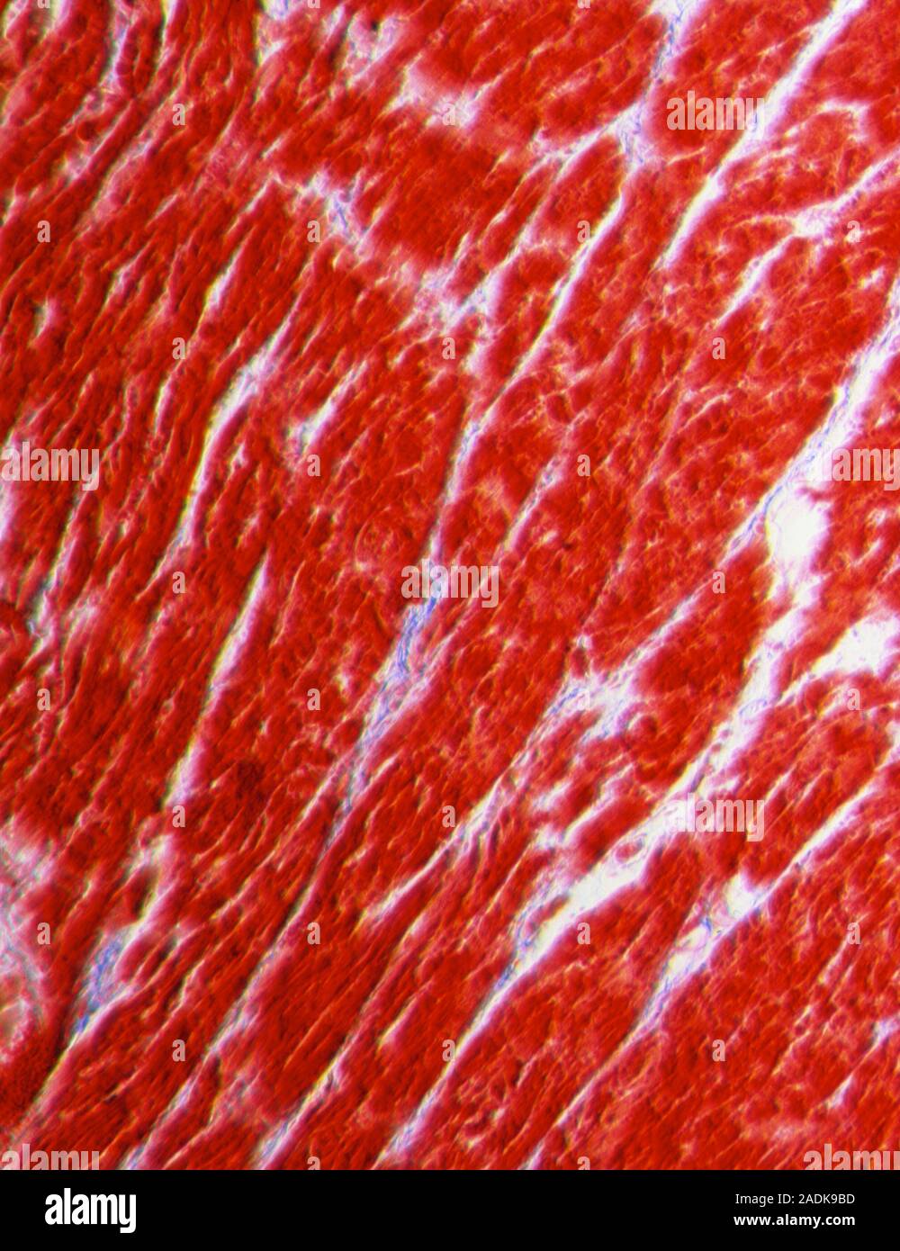 Heart muscle. Light micrograph of healthy heart (cardiac) muscle, seen ...