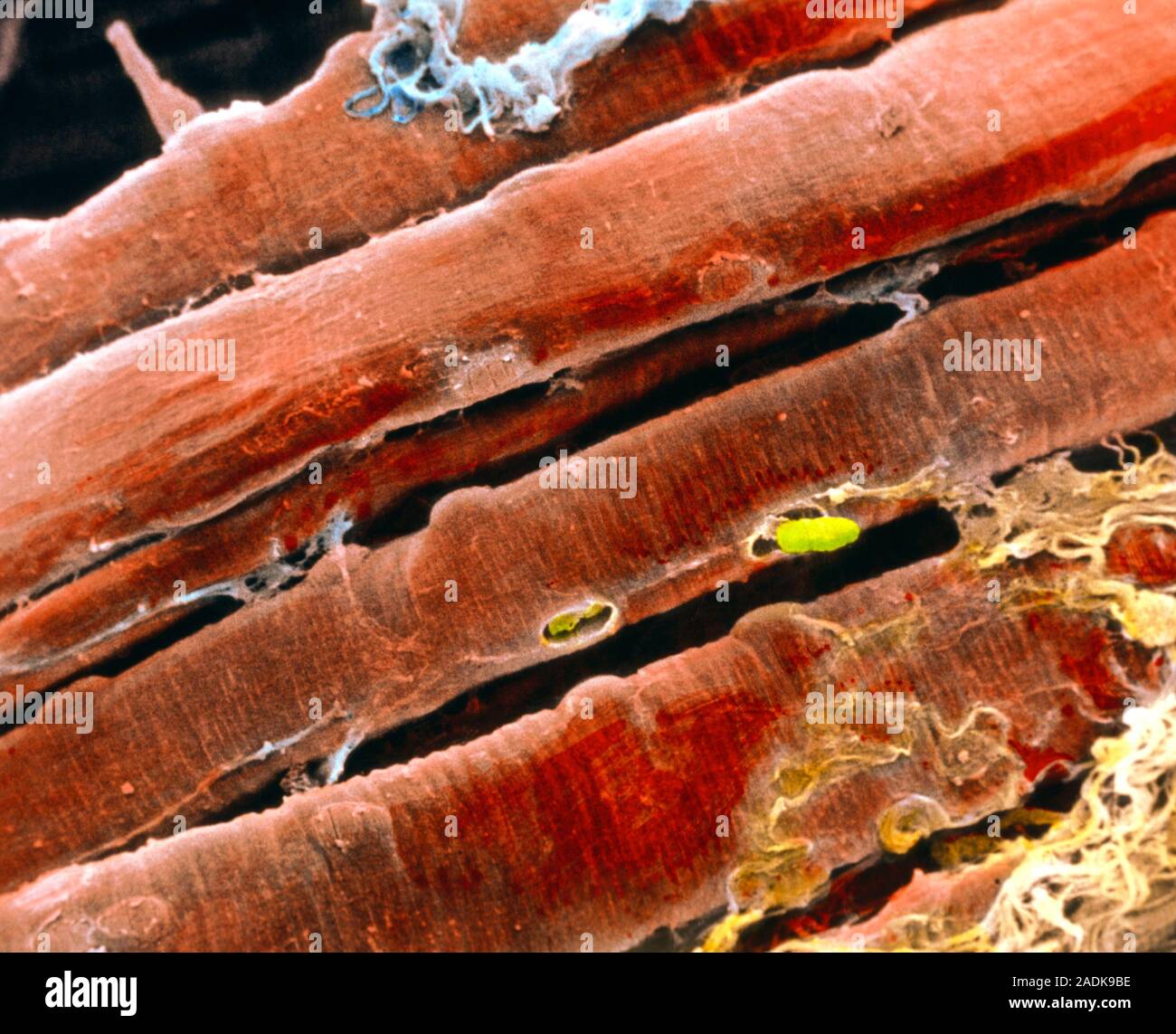 Muscle fibres. Coloured scanning electron micrograph showing a bundle of skeletal muscle fibres ...