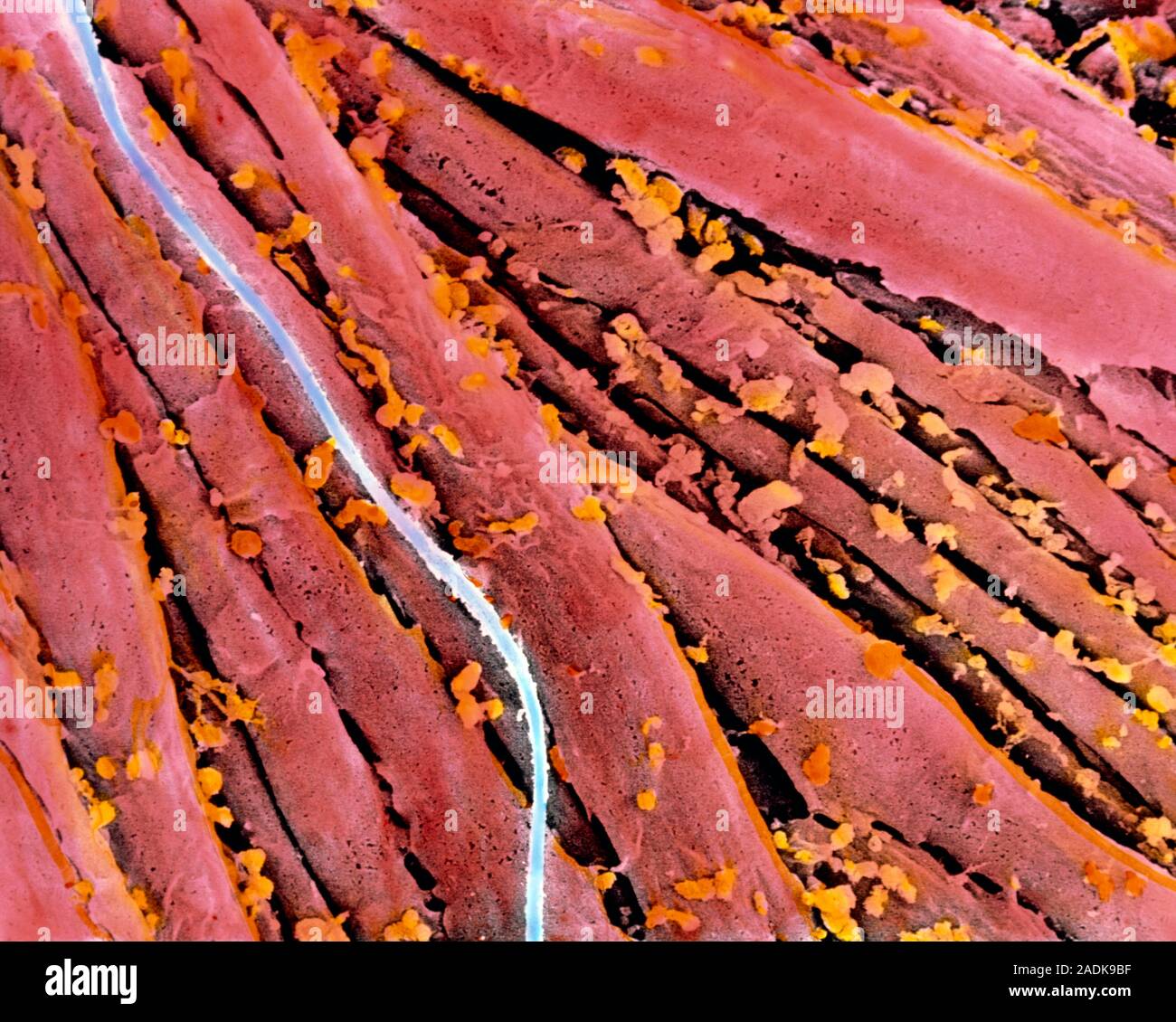 Smooth muscle in human oviduct. Coloured Scanning Electron Micrograph ...