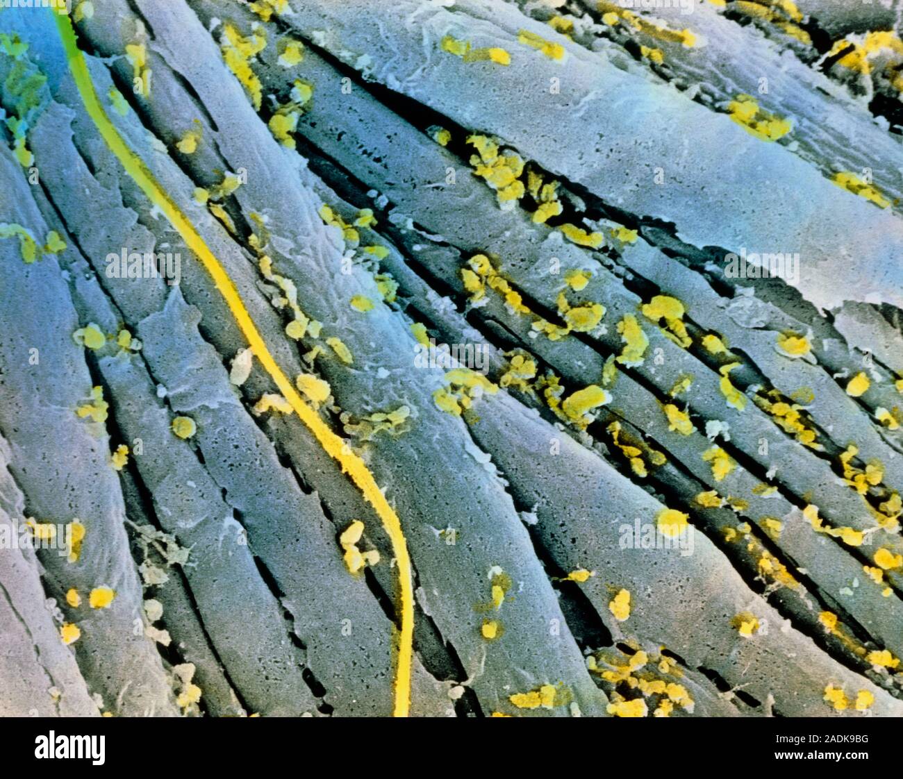 Smooth muscle in human oviduct. Coloured Scanning Electron Micrograph ...