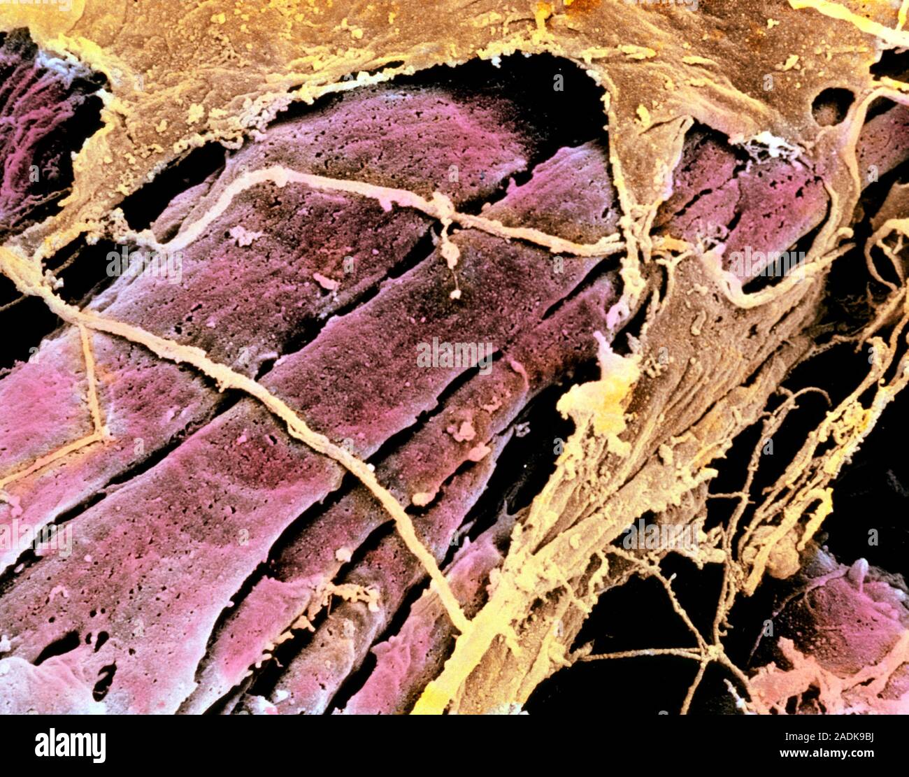 Smooth muscle in human oviduct. Coloured Scanning Electron Micrograph ...
