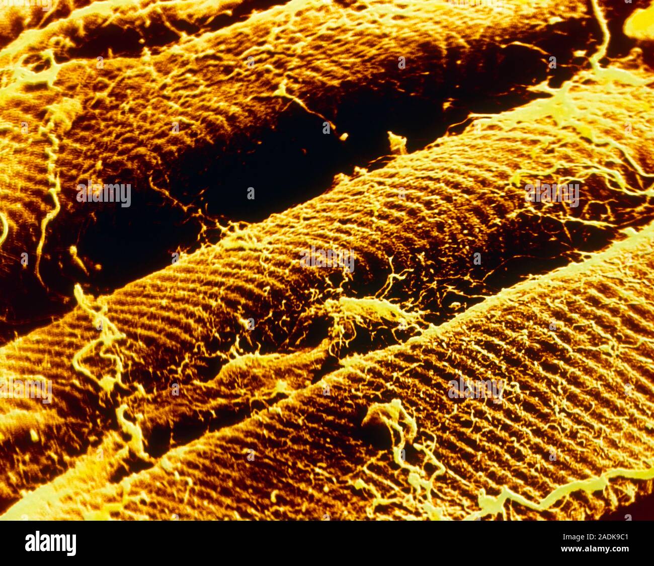 Striated muscle. Coloured Scanning Electron Micrograph (SEM) of human striated muscle fibres ...