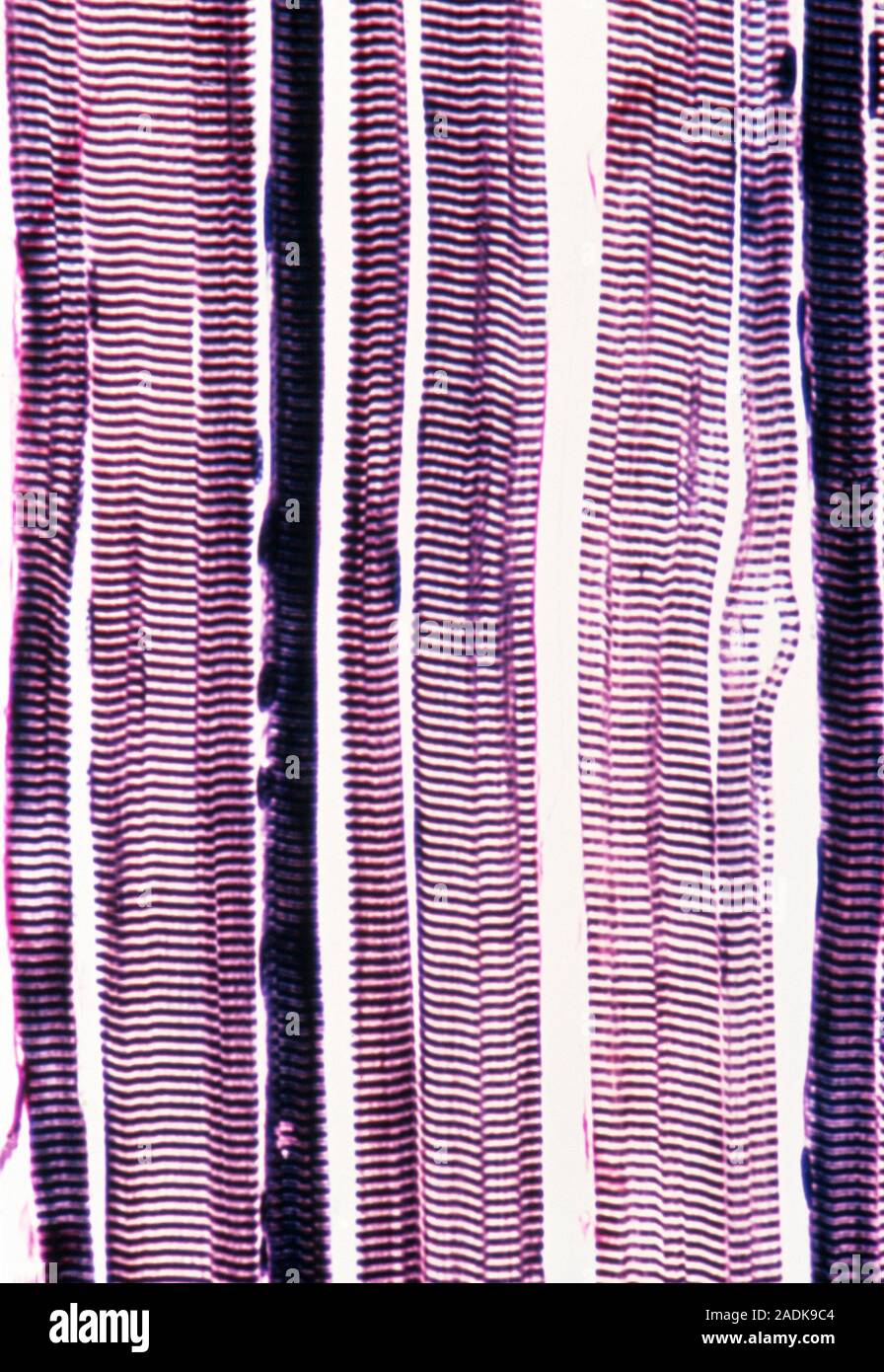 Skeletal muscle. Light micrograph of a longitudinal section through ... Skeletal muscle. Light micrograph of a longitudinal section through ...