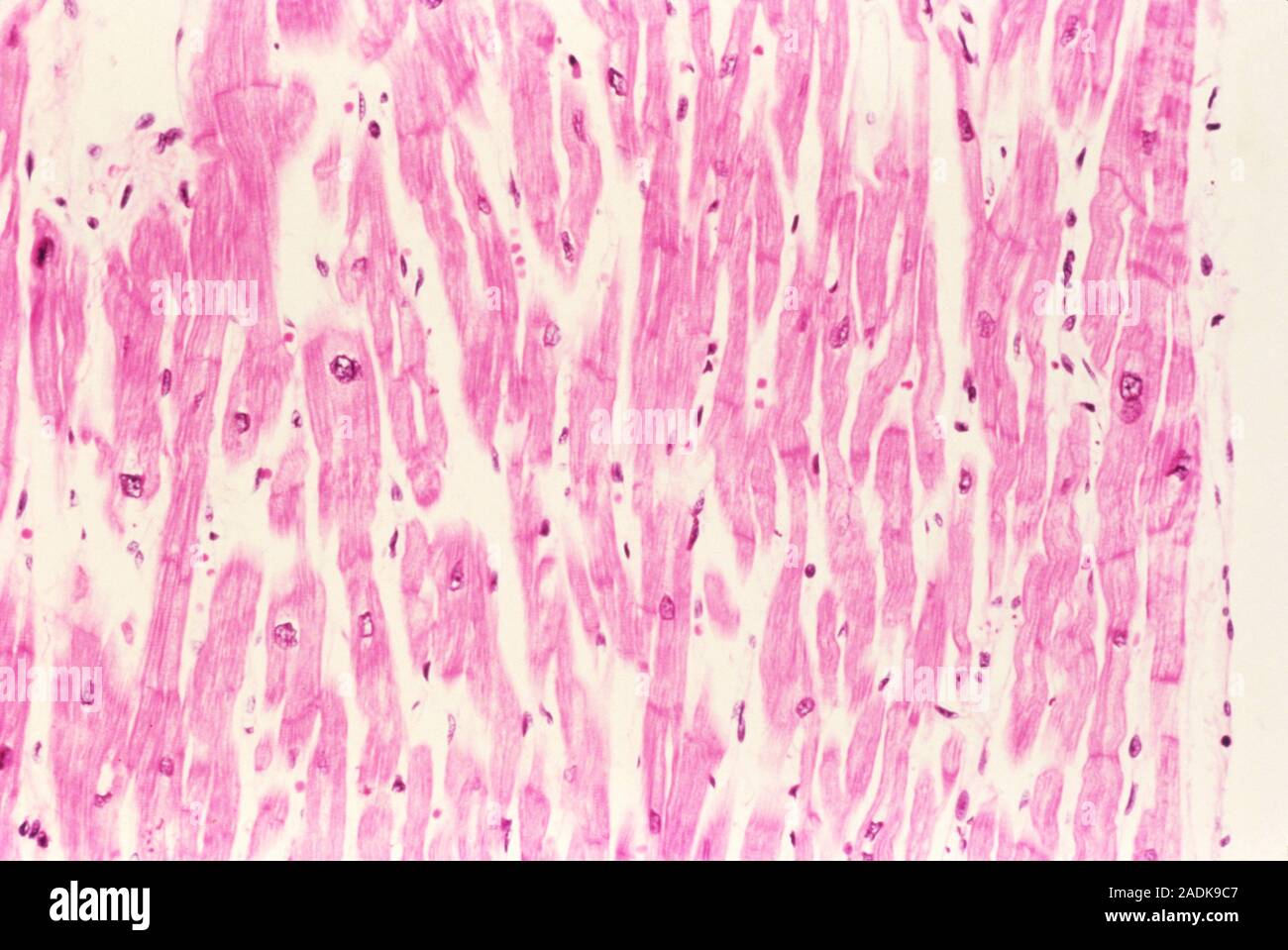 Heart tissue. Light micrograph of a longitudinal section through the ...