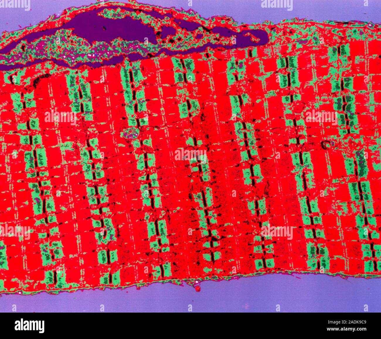 Striated muscle. Coloured transmission electron micrograph (TEM) of a longitudinal section ...