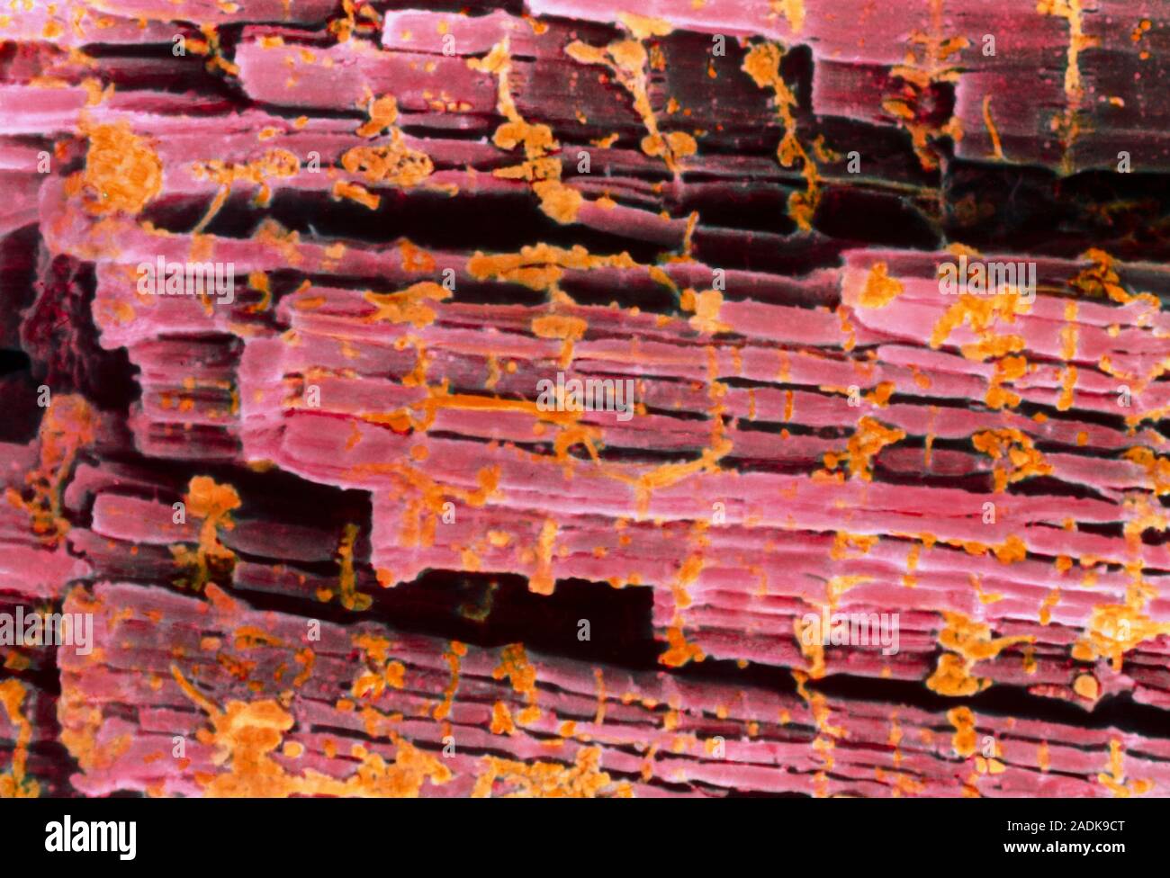 Striated muscle. Coloured scanning electron micrograph (SEM) of human striated muscle. Striated ...