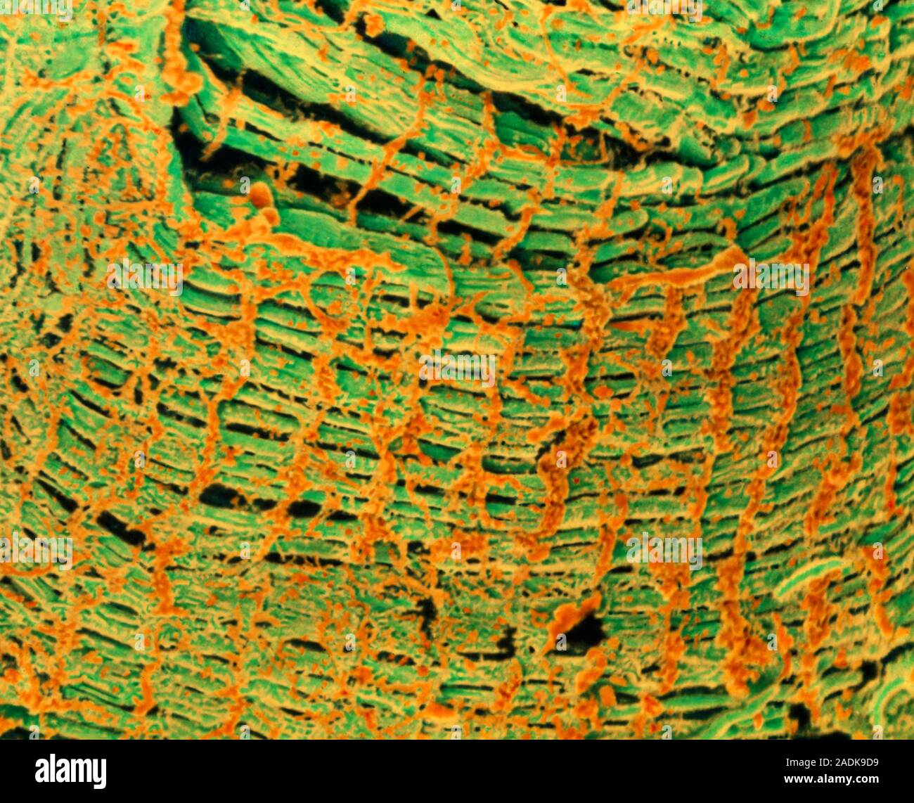 Striated muscle. Coloured scanning electron micrograph (SEM) of human striated muscle. Striated ...