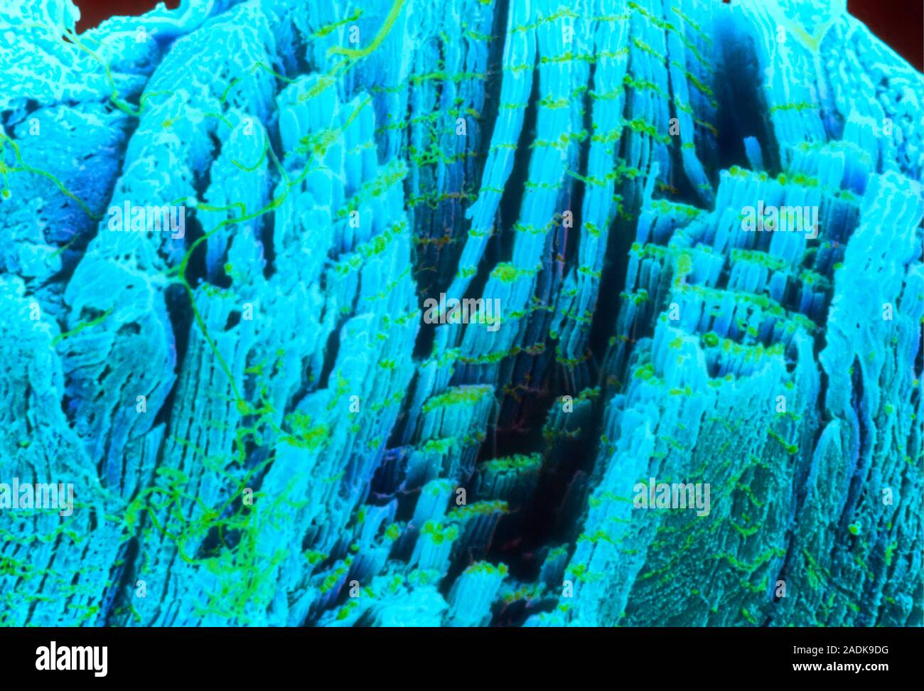 Striated muscle. Coloured scanning electron micrograph (SEM) of human striated muscle fibres ...