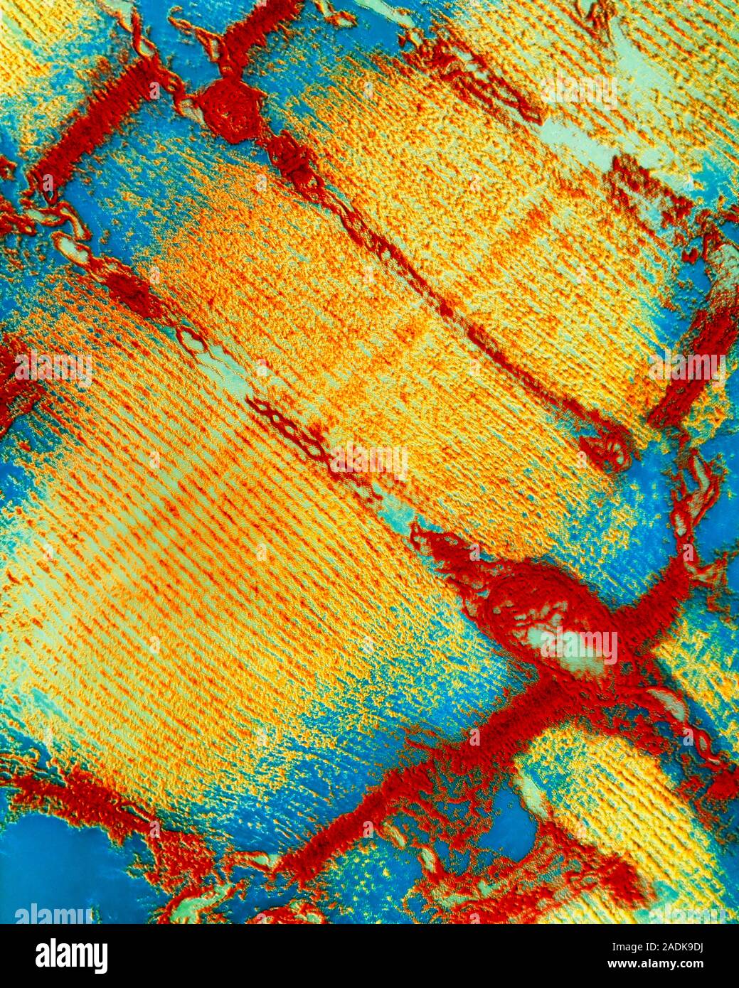 Skeletal muscle. Coloured transmission electron micrograph (TEM) of a section through skeletal ...