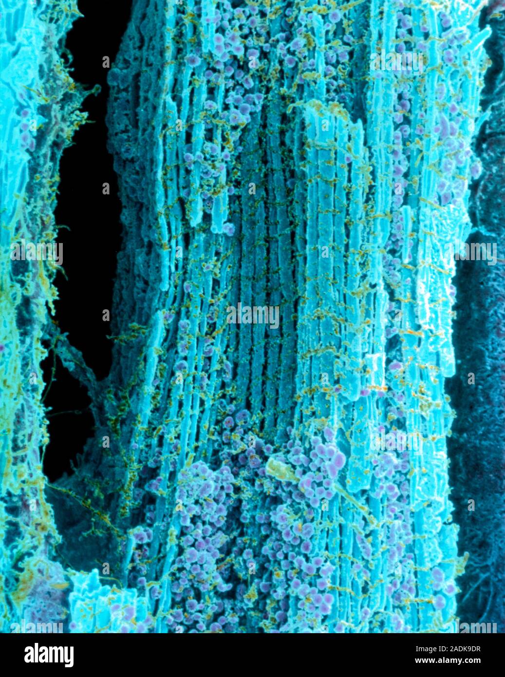 Heart muscle. Coloured scanning electron micrograph (SEM) of healthy ...