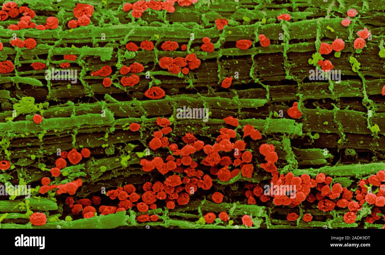 Heart muscle. Coloured scanning electron micrograph (SEM) of healthy ...