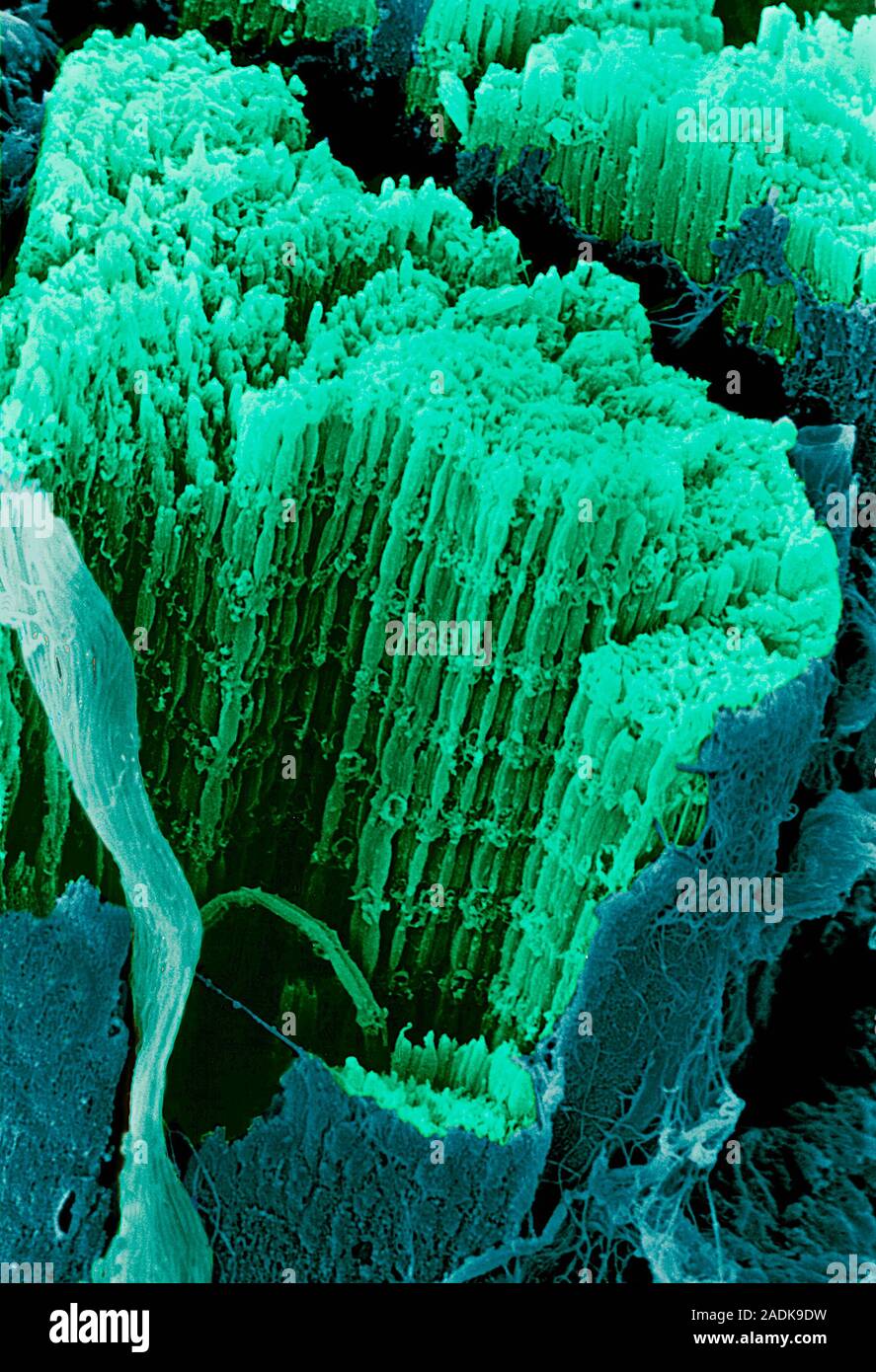 Skeletal muscle. Coloured scanning electron micrograph (SEM) of skeletal (striated) muscle ...