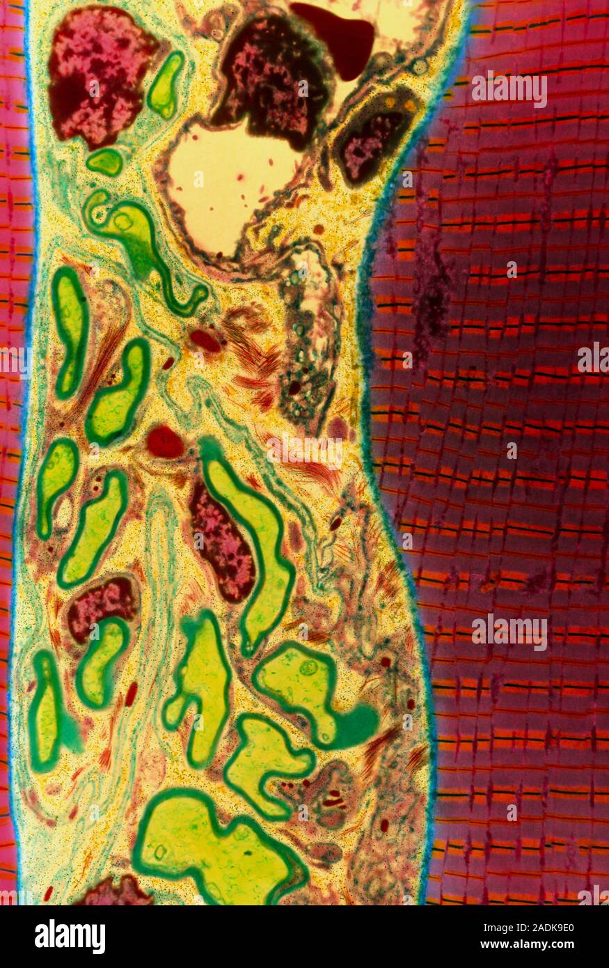 Skeletal muscle. Coloured transmission electron micrograph (TEM) of a section through skeletal ...